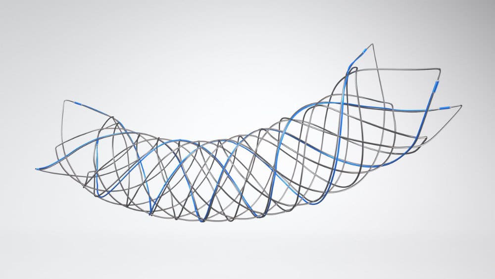 Tratamento de Aneurisma Cerebral com Stent e Diversor de Fluxo