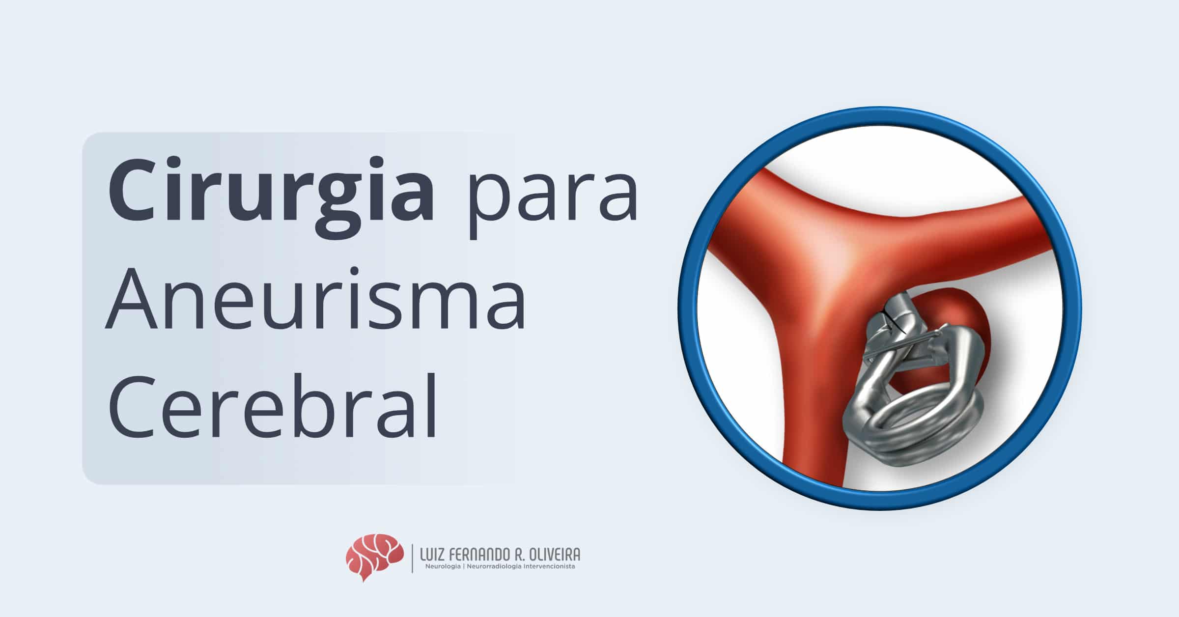 Cirurgia para Aneurisma Cerebral - Dr. Luiz Fernando Oliveira